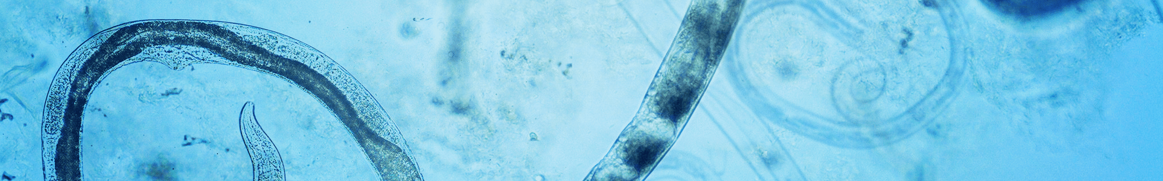 Aaltjes tegen plagen | ECOstyle producten 🪱 – ECOstyle Belgium